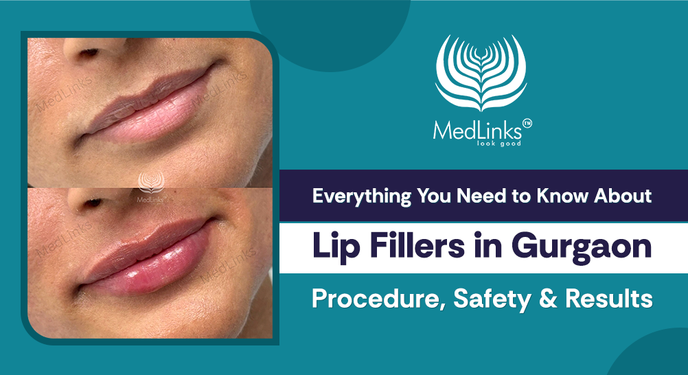 Everything You Need to Know About Lip Fillers in Gurgaon | MedLinks